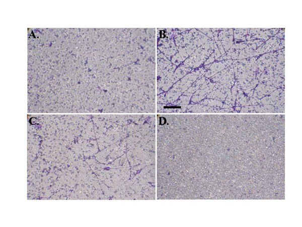 Neurite Outgrowth Assay Kit (3 µm) | NS220
